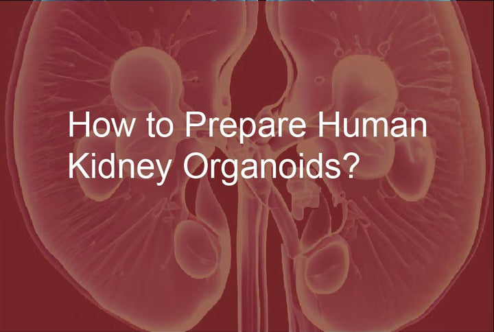 How to Prepare Human Kidney Organoids – Arcegen